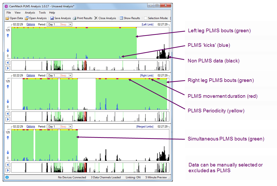 PLMS Software - CamNtech